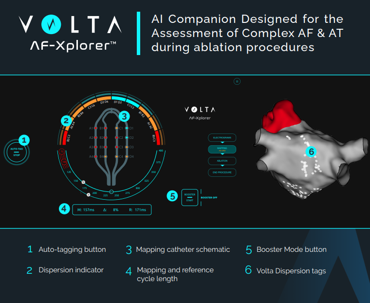 AI Guided AFIB Ablation – can it become a reality? – Cardio Cypher